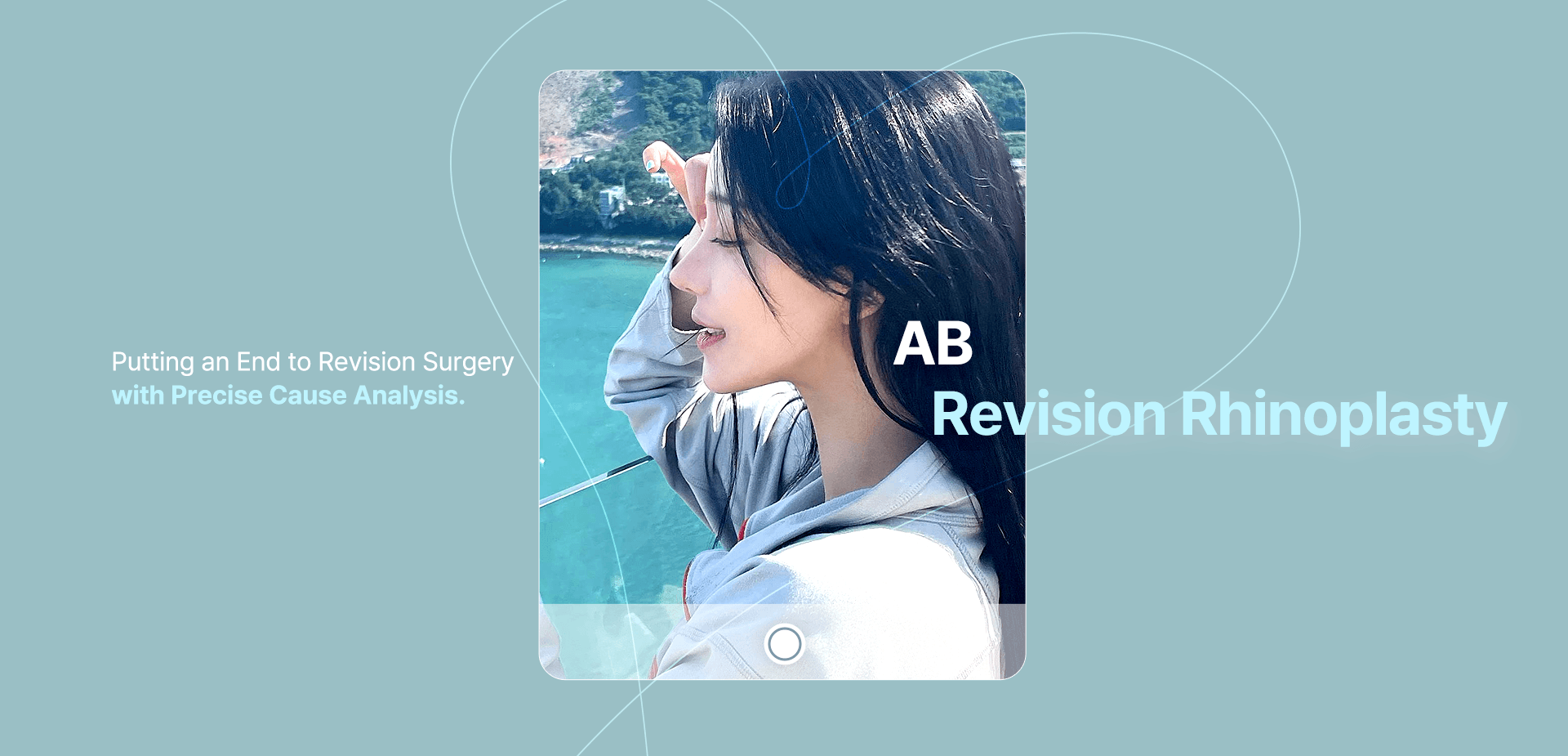 Revision Rhinoplasty | Nose job | AB Plastic Surgery