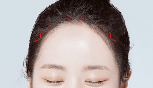 Forehead Reduction | AB Plastic Surgery
