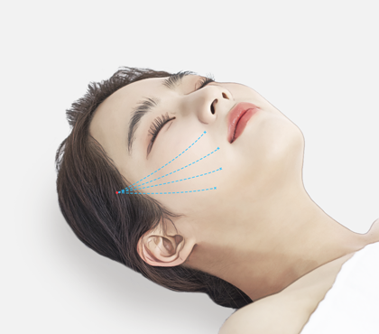 Thread Lift | Anti-aging | AB Plastic Surgery Korea