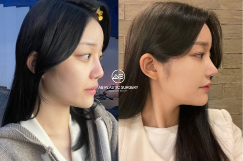 how to draw attention away from your nose