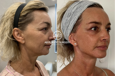 Seasonal Timing: The Best and Worst Times of Year for Plastic Surgery ...