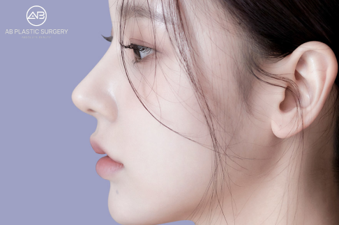 Hawk Nose Surgery in Korea: Complete Guide and Pre-Operation Checklist