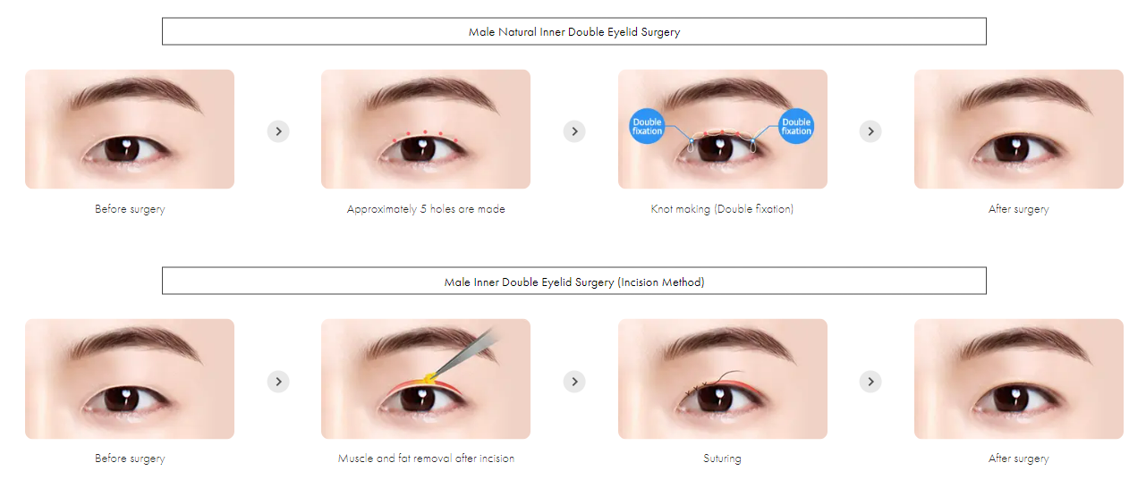 Mastering Masculinity: Male Plastic Surgery in Korea | AB Plastic Surgery